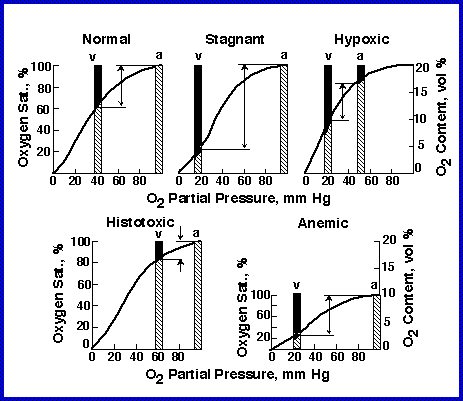 DIFFERENCES BETWEEN THE TYPES OF HYPOXIA – The Lay Medical Man